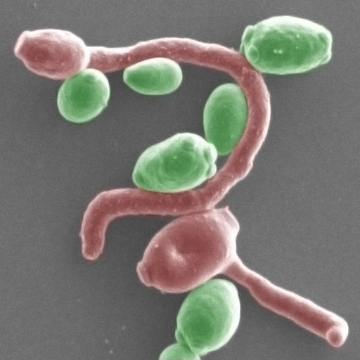 Candida Infections and CFS/ME/FM - Learning to heal with Chronic Fatigue